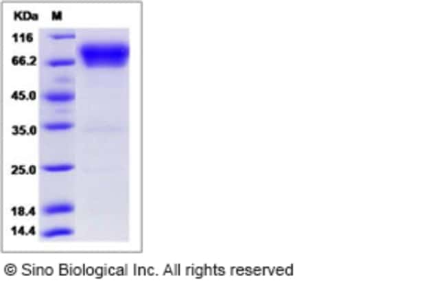 Sino Biological Human B7-H4 / B7S1 / B7x Protein (Fc Tag), Biotinylated ...