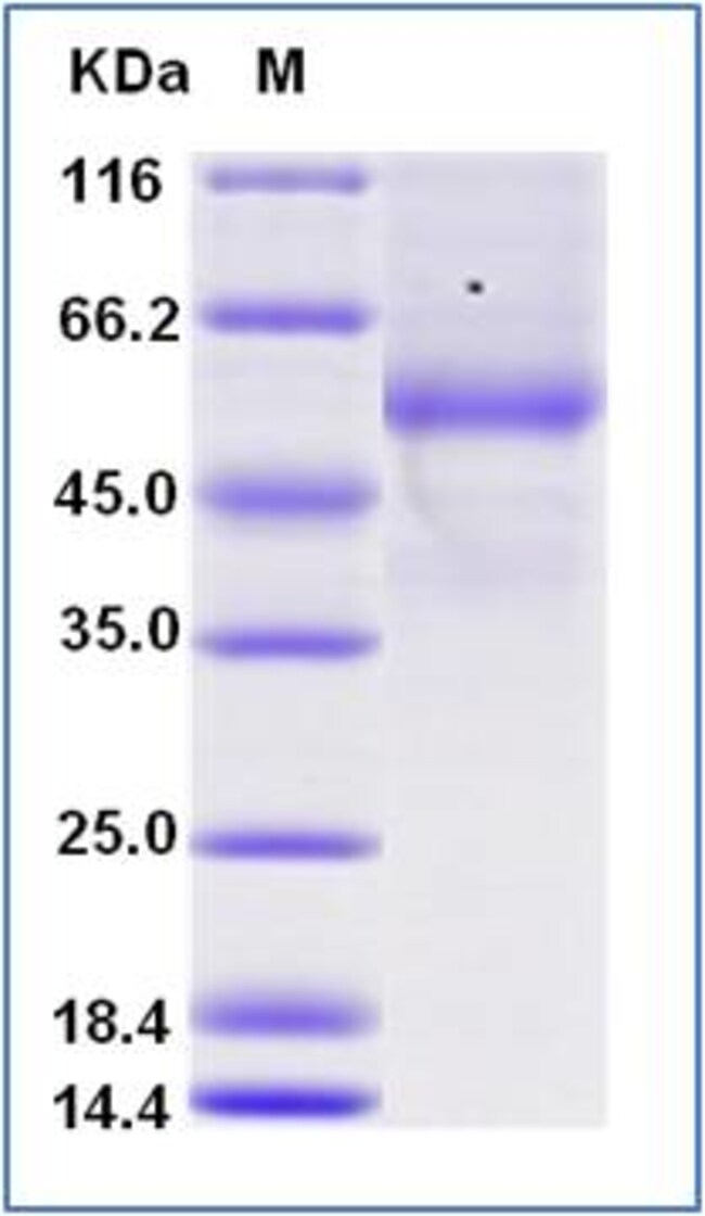 Sino Biological Human CD70 / CD27L / TNFSF7 Protein (Fc & AVI Tag ...