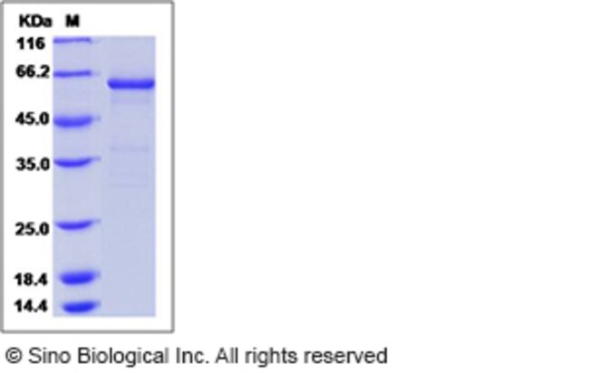 Sino Biological Human CD73 / NT5E Protein (His Tag), Quantity: Each of ...