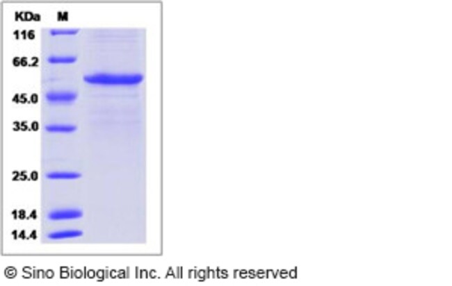 Sino Biological Human NNT1 / CLCF1 / CLC Protein (Fc Tag) 1mg, Quantity ...