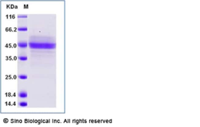 Sino Biological Human CD3e / CD3 epsilon Protein (Fc Tag) 50ug ...