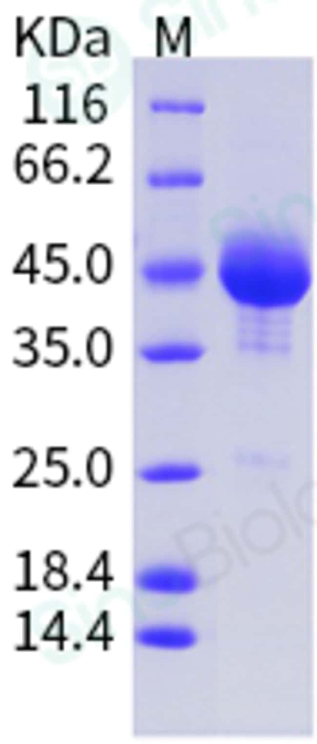 Sino Biological CD3 epsilon/CD3e Protein, Human, Recombinant (hFc ...
