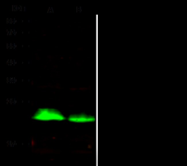 Sino Biological CD3d / CD3 delta Antibody, Rabbit MAb 50uL, Quantity ...