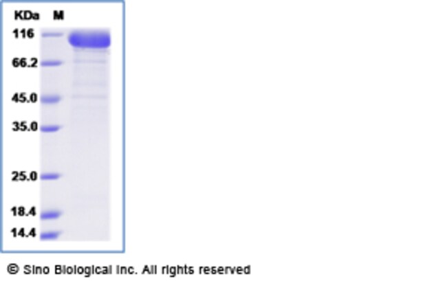 Sino Biological Human TFRC / CD71 Protein (Fc Tag) 500ug, Quantity ...