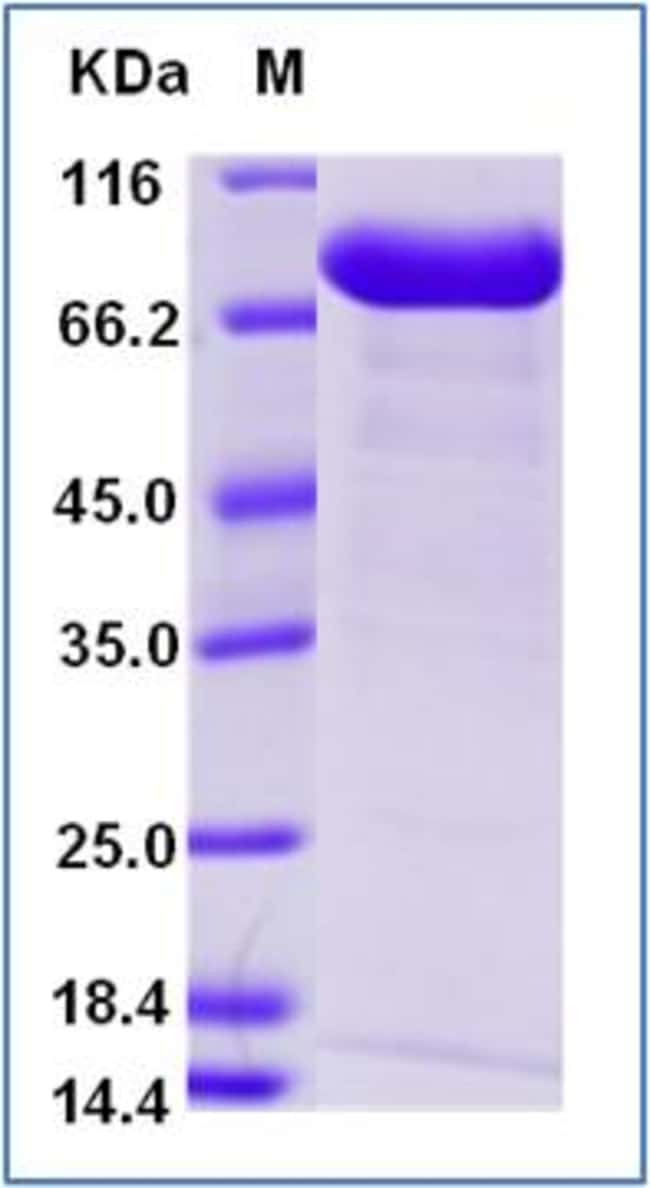 Sino Biological Human CD5 / Cluster of Differentiation 5 Protein (Fc ...