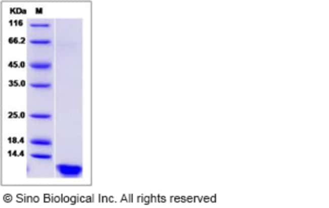 Sino Biological Human Insulin / INS Protein 100ug, Quantity: Each of 1 ...