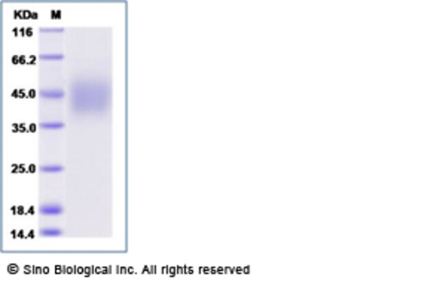 Sino Biological Human CD16b / FCGR3B Protein (NA2 allotype, His & AVI ...