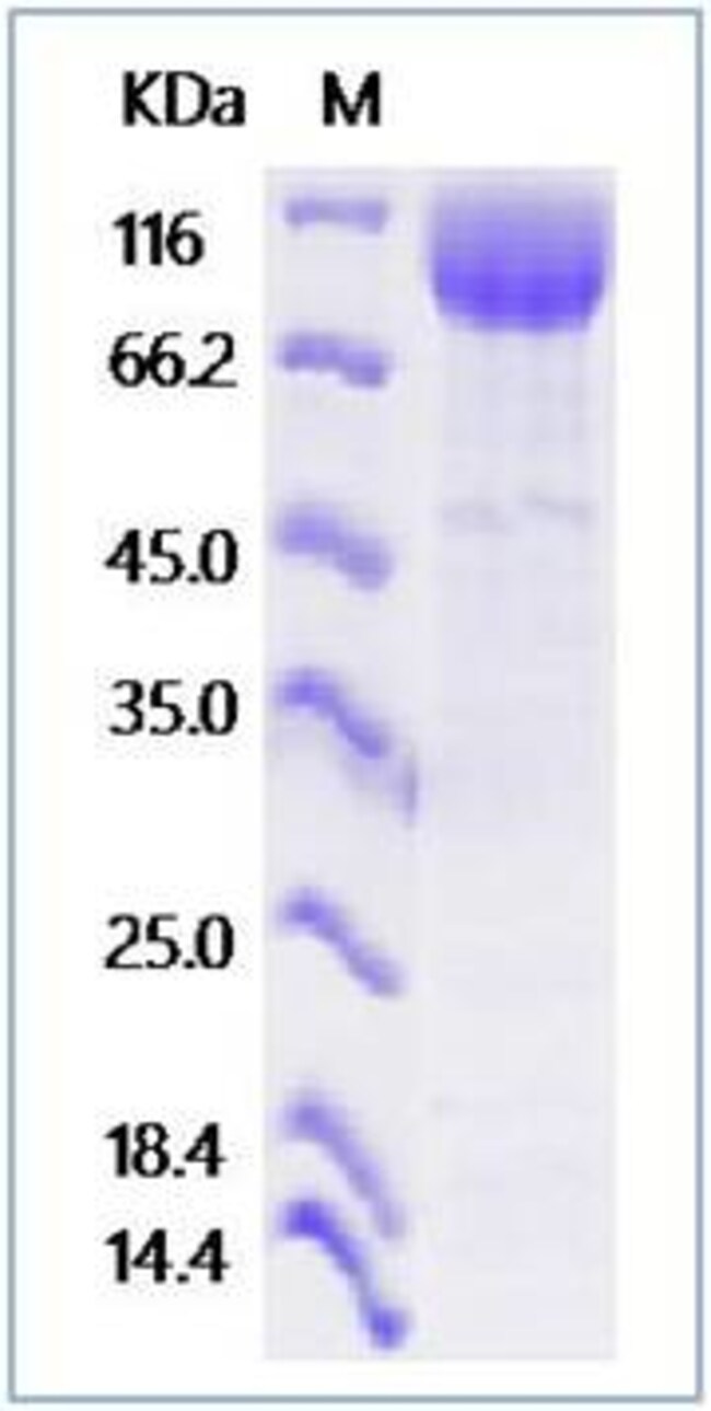 Sino Biological LIMPII/SR-B2 Protein, Human, Recombinant (hFc Tag ...