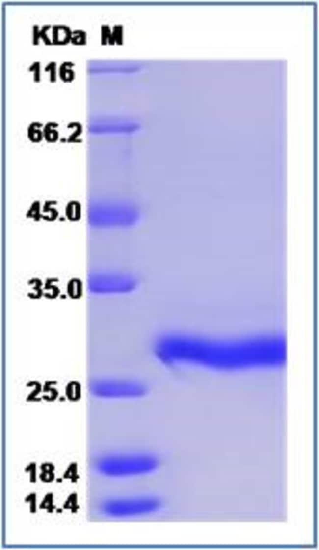 Sino Biological Human VEGF / VEGFA / VEGF165 Protein (His & AVI Tag ...