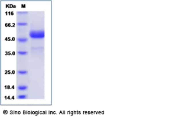 Sino Biological Human CTLA4 / CD152 Protein (Fc Tag) 1mg, Quantity ...