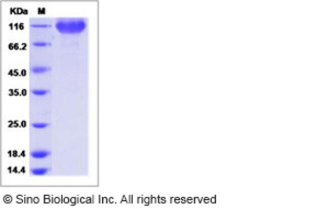 Sino Biological Human B7-H3 / CD276 Protein (ECD, Fc Tag), Biotinylated ...