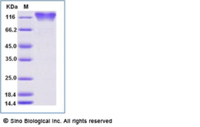 Sino Biological Human CD68 Protein (Fc Tag) 100ug, Quantity: Each of 1 ...