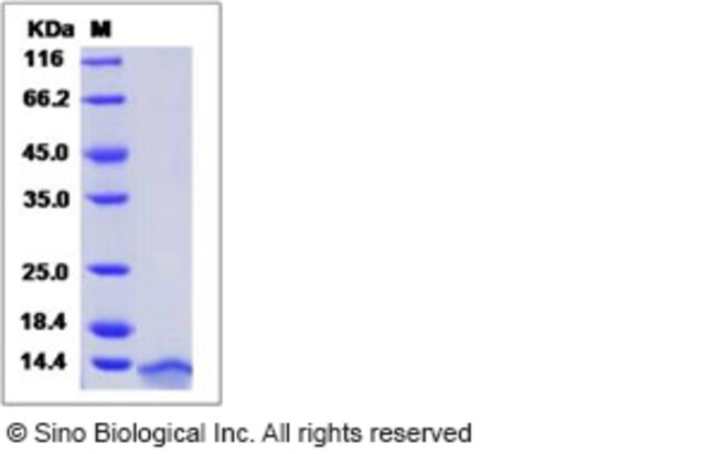 Sino Biological Human CCL3 / Mip1a Protein (His Tag) 1mg, Quantity ...