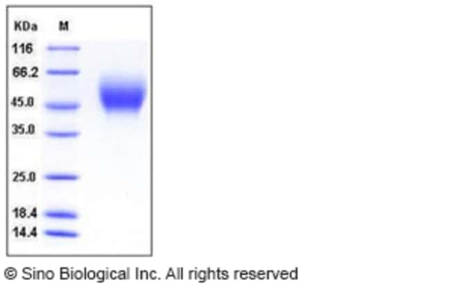 Sino Biological Human CD111 / Nectin-1 / PVRL1 Protein (His Tag) 1mg ...