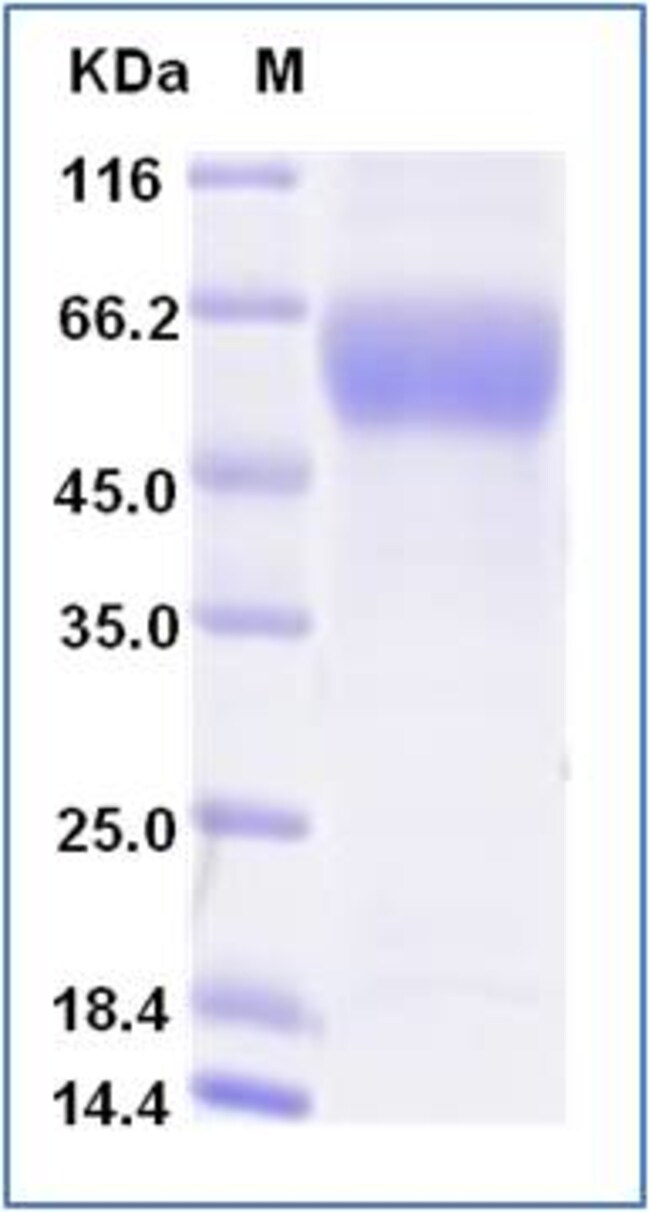 Sino Biological Human SIRP alpha Protein (His & AVI Tag), Biotinylated ...