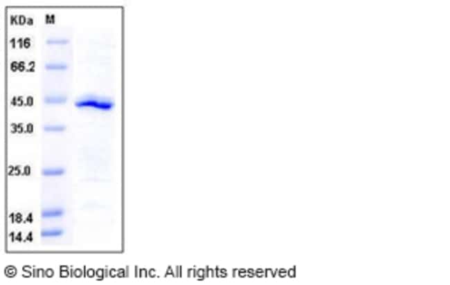 Sino Biological Human IDO1 / IDO Protein (His Tag) 50ug, Quantity: Each ...