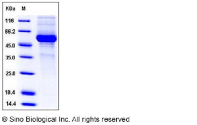 Sino Biological Human RANKL / OPGL / TNFSF11 / CD254 Protein (ECD, Fc ...