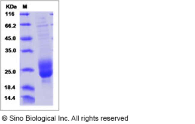 Sino Biological M-CSF Protein, Human, Recombinant, Biotinylated 100g ...