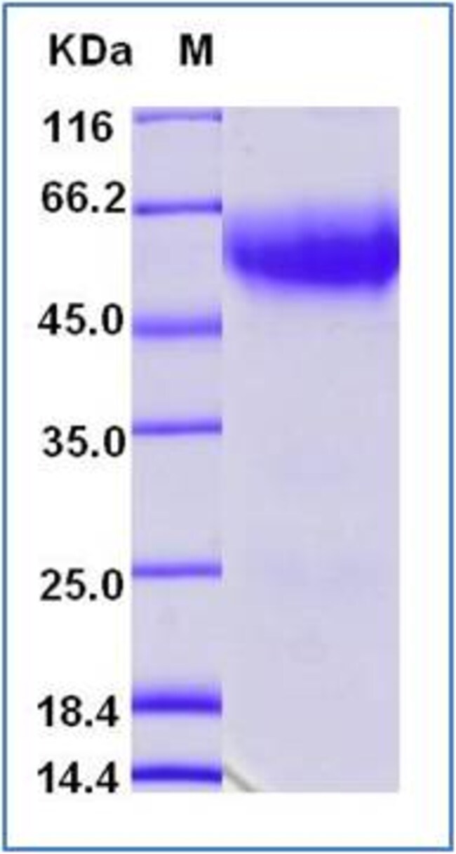 Sino Biological SELL/CD62L Protein, Human, Recombinant (ECD, His Tag ...