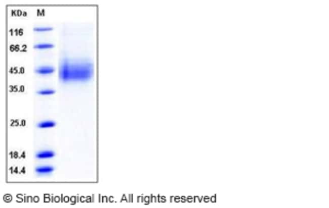 Sino Biological CLEC12A Protein, Human, Recombinant (ECD, His Tag) 1mg ...