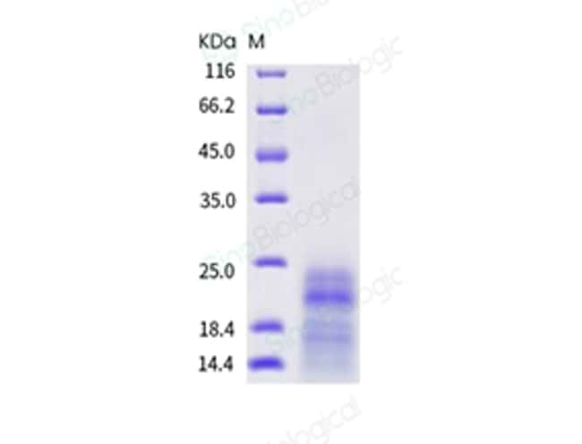 Sino Biological Human TNFRSF13B / TACI / CD267 Protein (ECD, His Tag ...