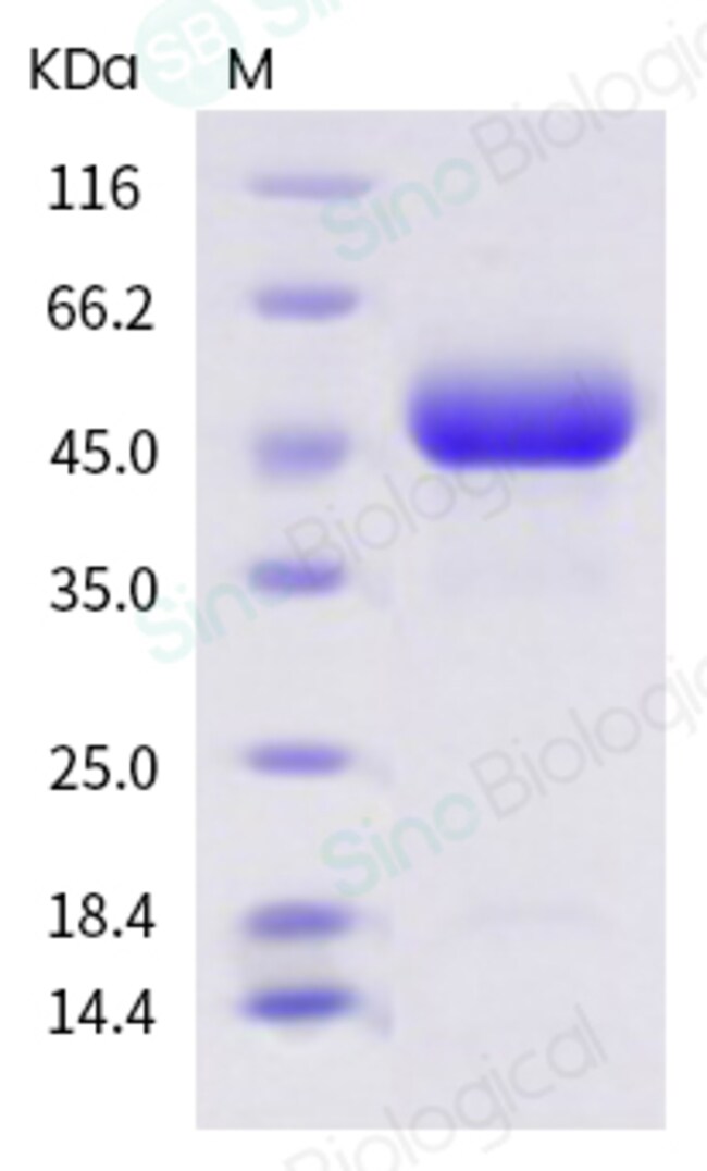 Sino Biological Human alpha-Galactosidase A / GLA Protein (His Tag ...