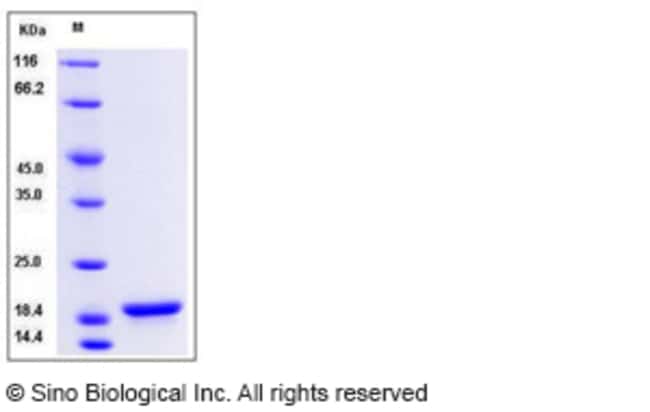 Sino Biological Human SNCA / alpha-Synuclein Protein 1mg, Quantity ...