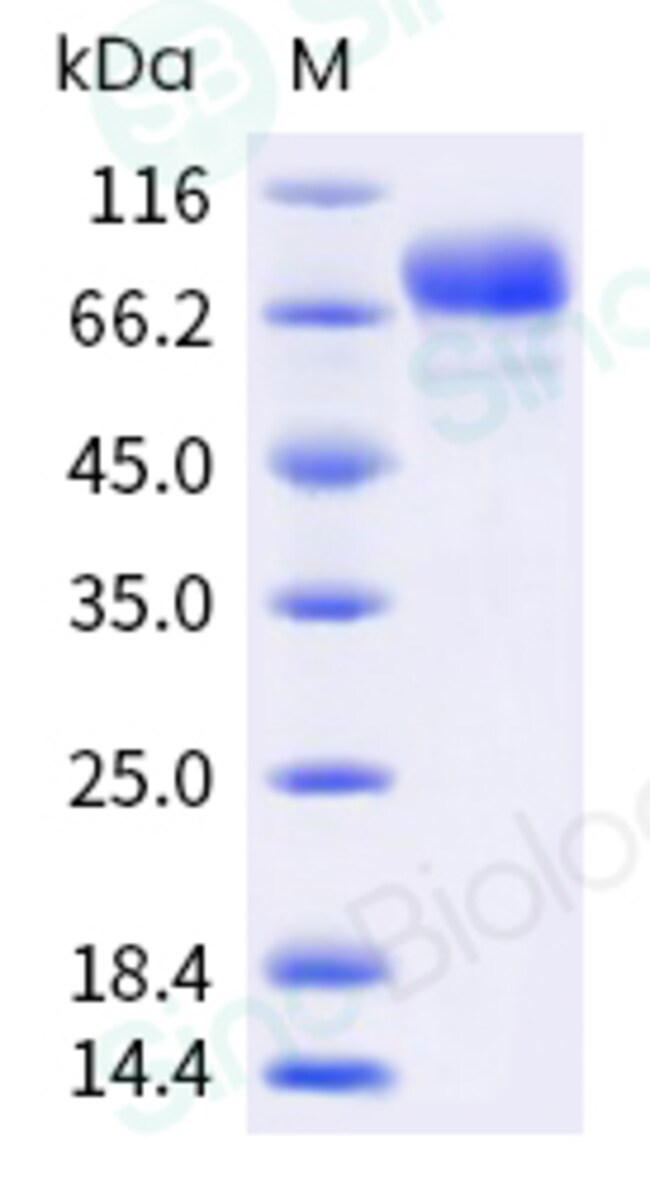 Sino Biological Human CD33 / Siglec-3 Protein (Fc Tag) 100ug, Quantity ...