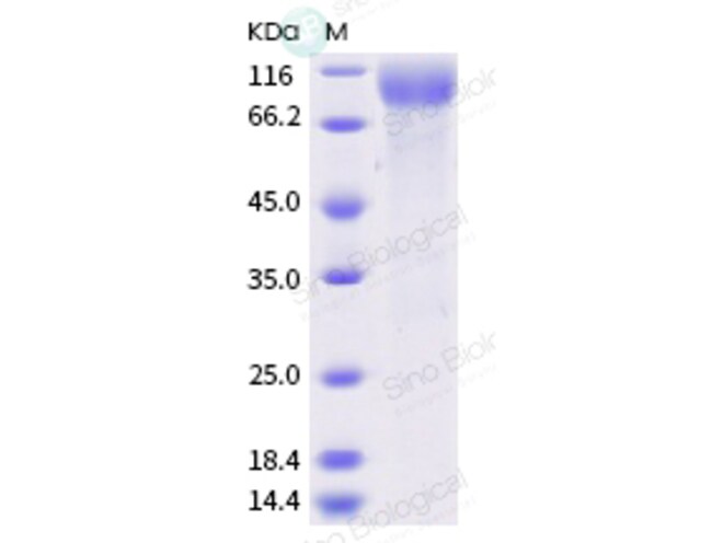 Sino Biological MICA Protein, Human, Recombinant (ECD, hFc Tag) 200µg ...