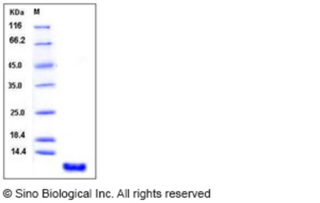 Sino Biological Human S100P / S100E Protein, Biotinylated 100ug ...