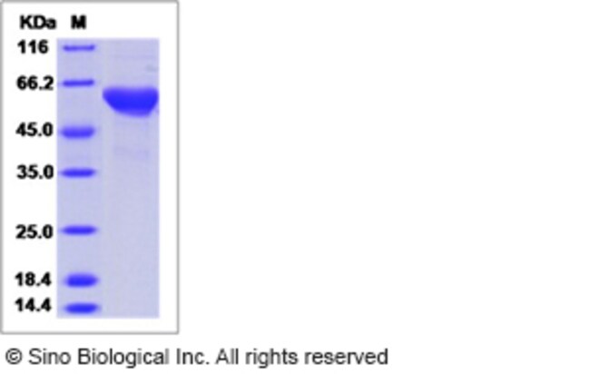 Sino Biological Human OX-40L / TNFSF4 / CD252 Protein (ECD, Fc Tag ...