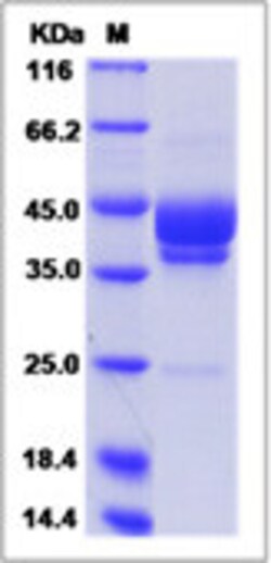 Sino Biological Human MSLN / Mesothelin Protein 500ug, Quantity: Each ...