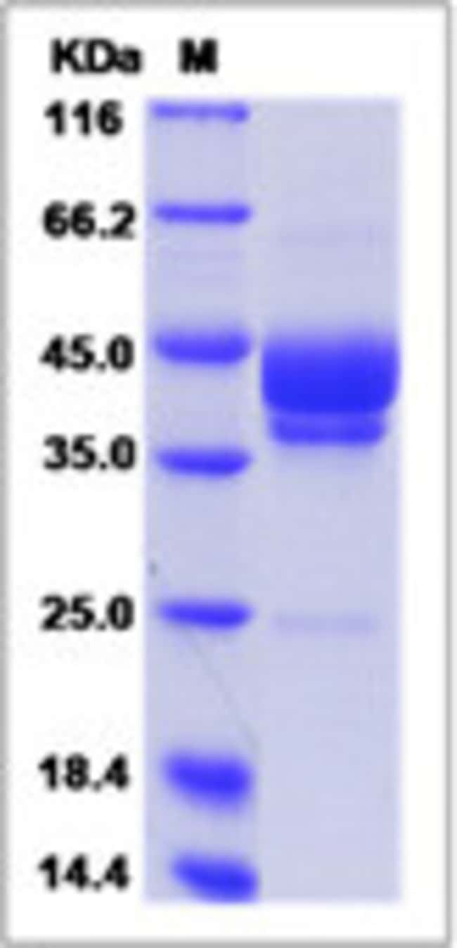 Sino Biological Human MSLN / Mesothelin Protein 500ug, Quantity: Each ...