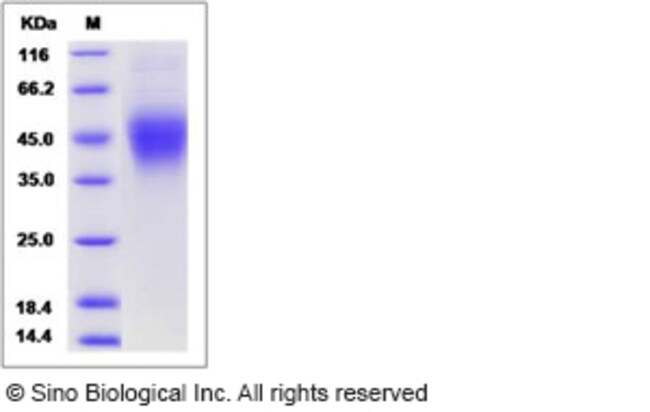 Sino Biological Human FcERI / FCER1A Protein (ECD,His Tag) 1mg | Fisher ...