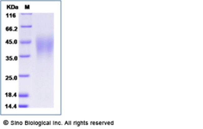Sino Biological Human FCER1A / Fc epsilon RI alpha Protein (ECD) 1mg ...