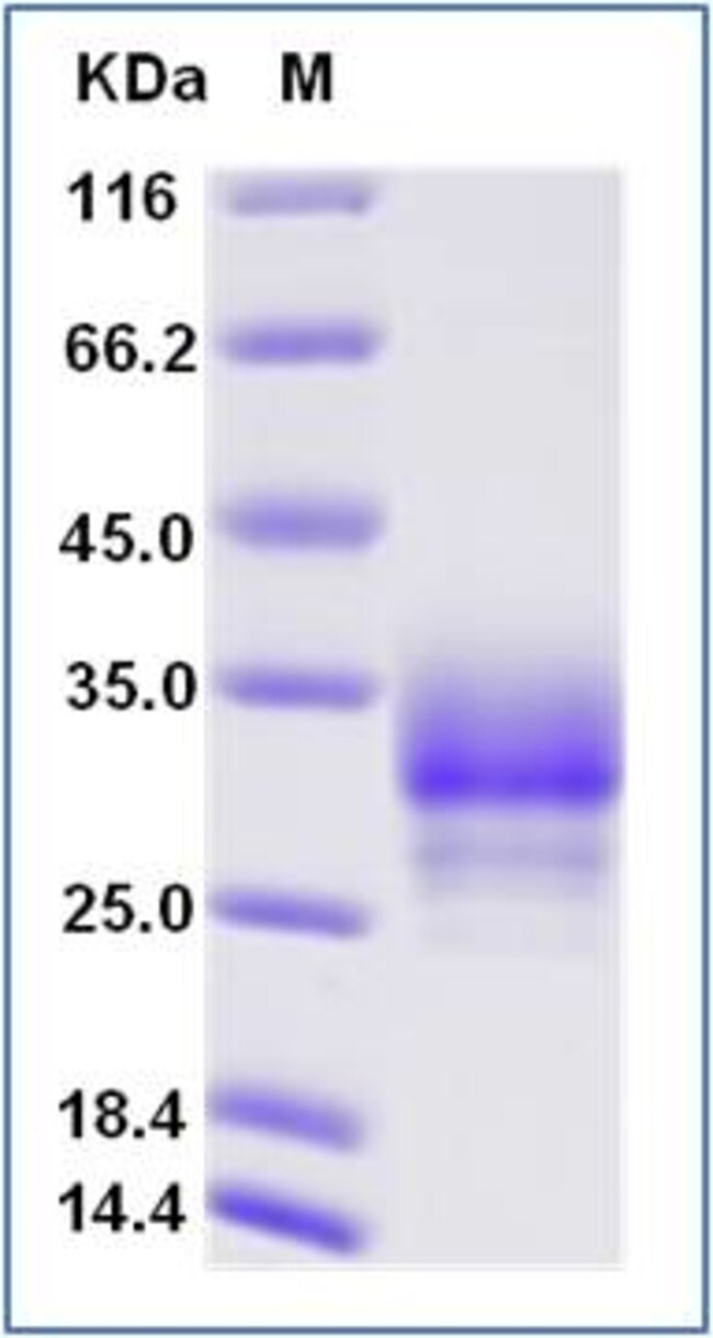 Sino Biological Human LAIR1 Protein (His & AVI Tag), Biotinylated 100ug ...