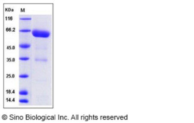 Sino Biological Human NRG1-alpha Protein (ECD, Fc Tag) 1mg, Quantity ...