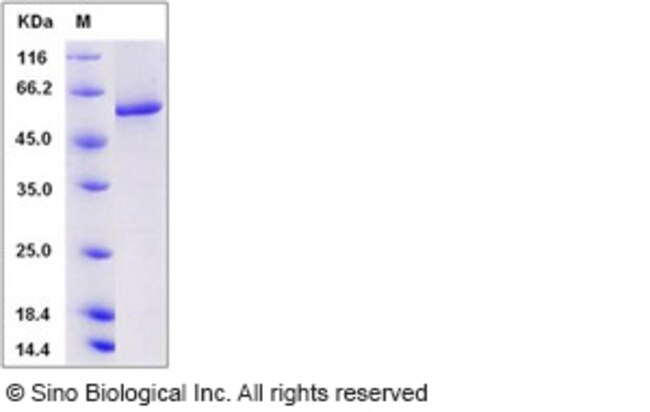 Sino Biological Human PPP3CA / Protein phosphatase 2B Protein (His Tag ...