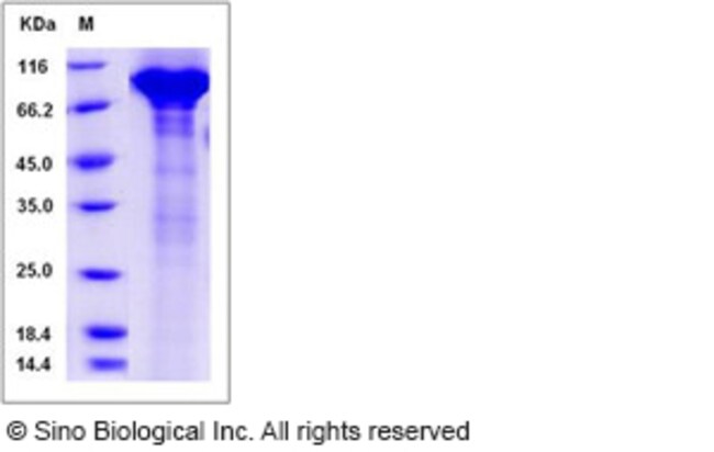 Sino Biological Human C7 / Complement component 7 Protein (His Tag) 1mg ...