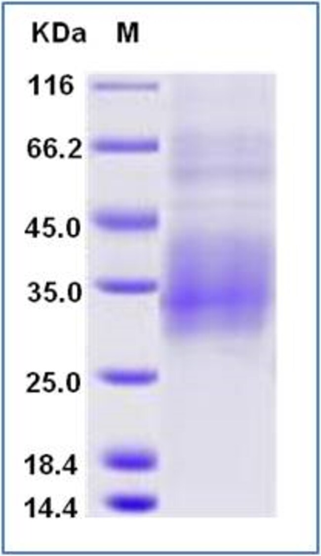 Sino Biological Human NKG2A / CD159A / KLRC1 Protein (His Tag ...