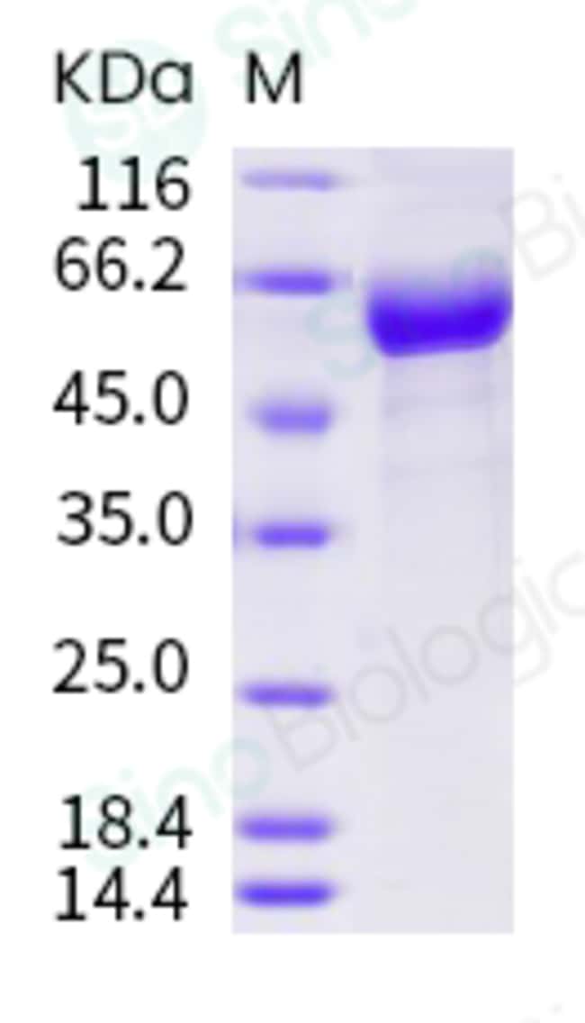 Sino Biological SIGLEC15 Protein, Human, Recombinant (ECD, hFc Tag ...