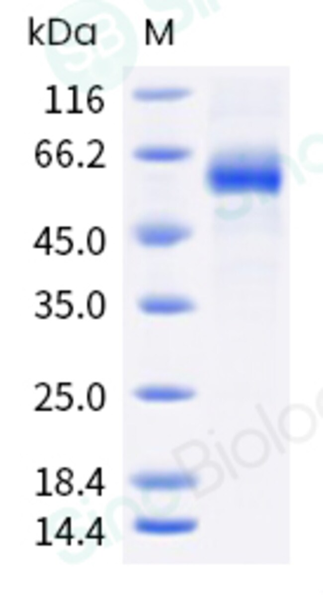 Sino Biological SIGLEC15 Protein, Human, Recombinant (ECD, hFc Tag ...