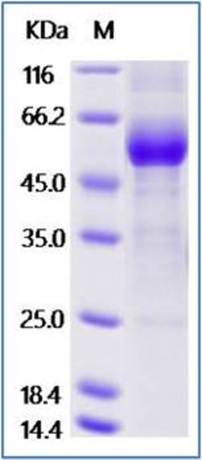 Sino Biological SIGLEC15 Protein, Human, Recombinant (ECD, mFc Tag ...
