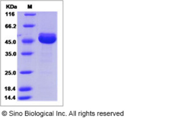 Sino Biological Human CDNF / ARMETL1 Protein (Fc Tag) 1mg, Quantity ...