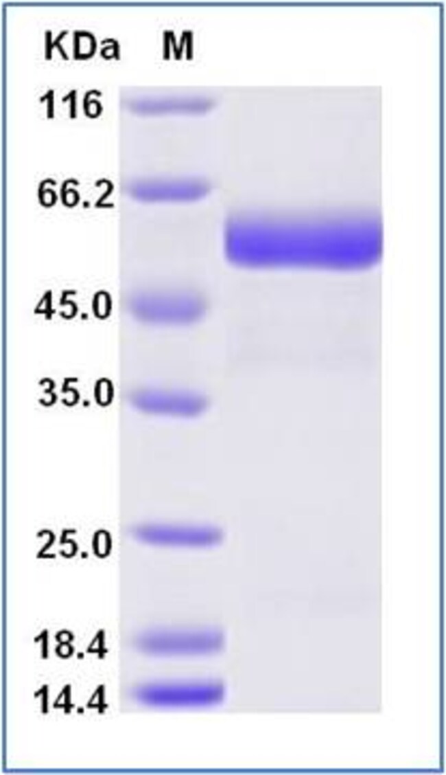 Sino Biological ROR2 Protein, Human, Recombinant (ECD, His & AVI Tag ...