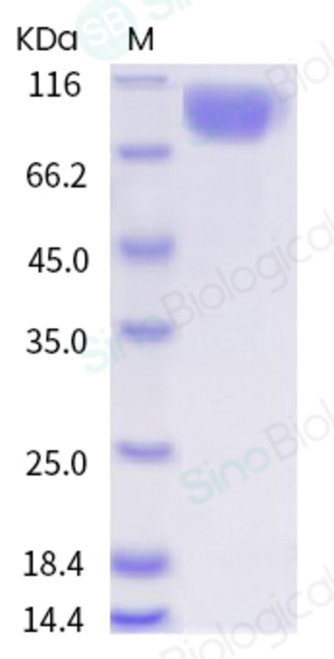 Sino Biological Human FGFR1 beta (IIIb) Protein (Fc Tag) 200ug ...