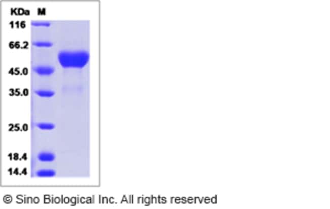 Sino Biological Human TL1A / TNFSF15 Protein (Fc Tag) 1mg, Quantity ...