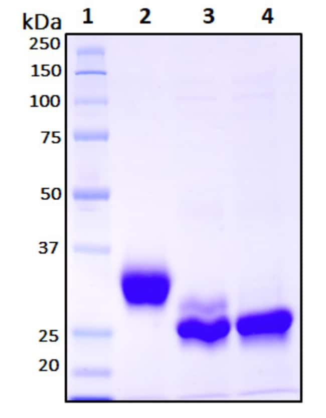 Raybiotech Inc Recombinant SARS-CoV-2, S1 Subunit Protein (RBD ...