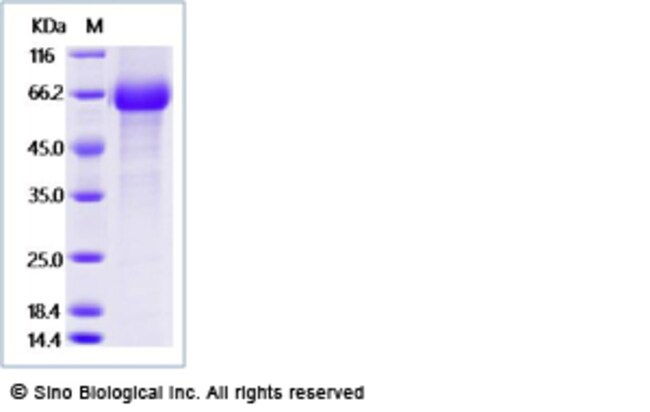 Sino Biological Human CRLF2 Protein (ECD, Fc Tag) 50ug, Quantity: Each ...