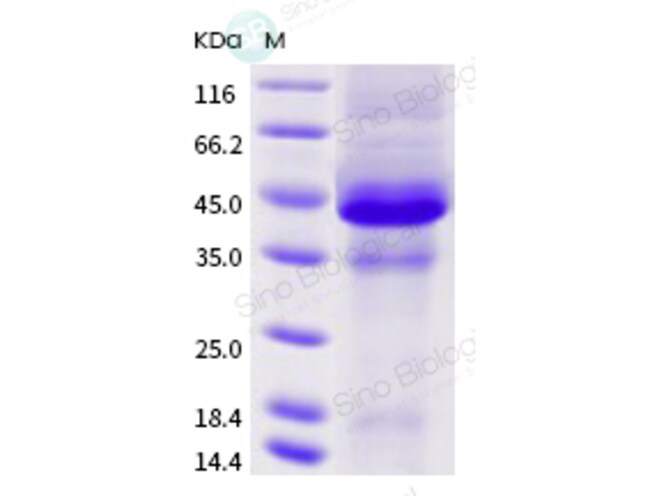 Sino Biological TACI Protein, Human, Recombinant (ECD, hFc Tag) 200µg ...